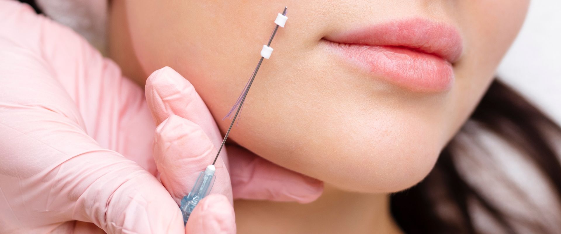 PDO Thread Lift Complications and Minimizing Risks