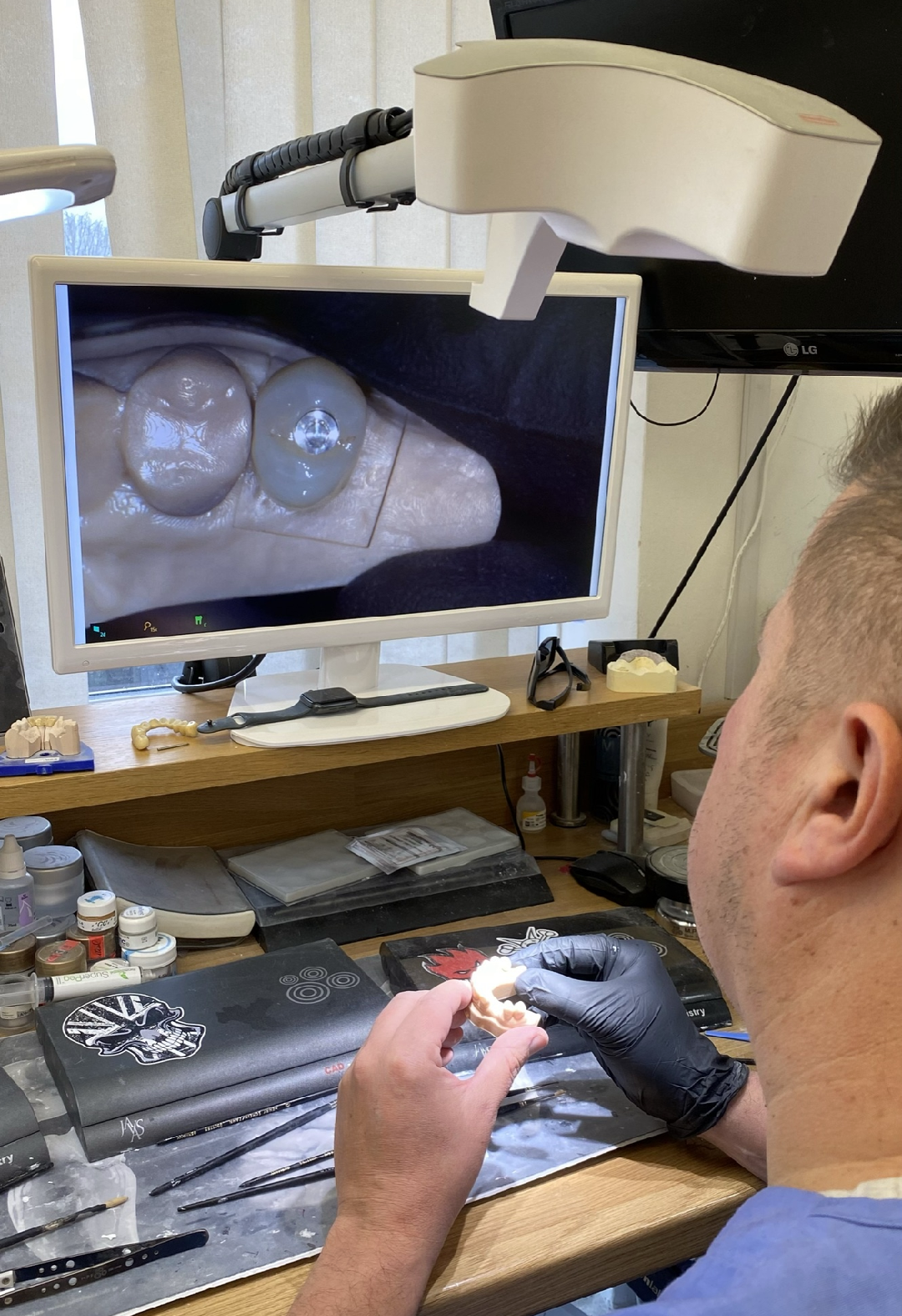 Toothworx dental Laboratory Cardiff Advanced DigitalDental Laboratory