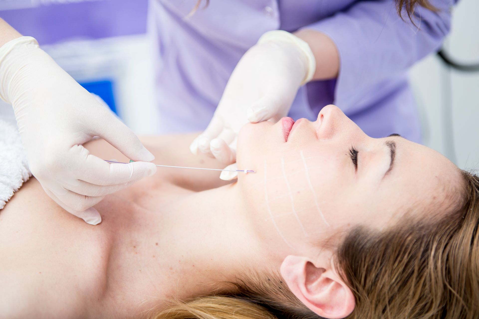 Botox in Connecticut | Expert Wrinkle Relaxing Treatments at Skin ...