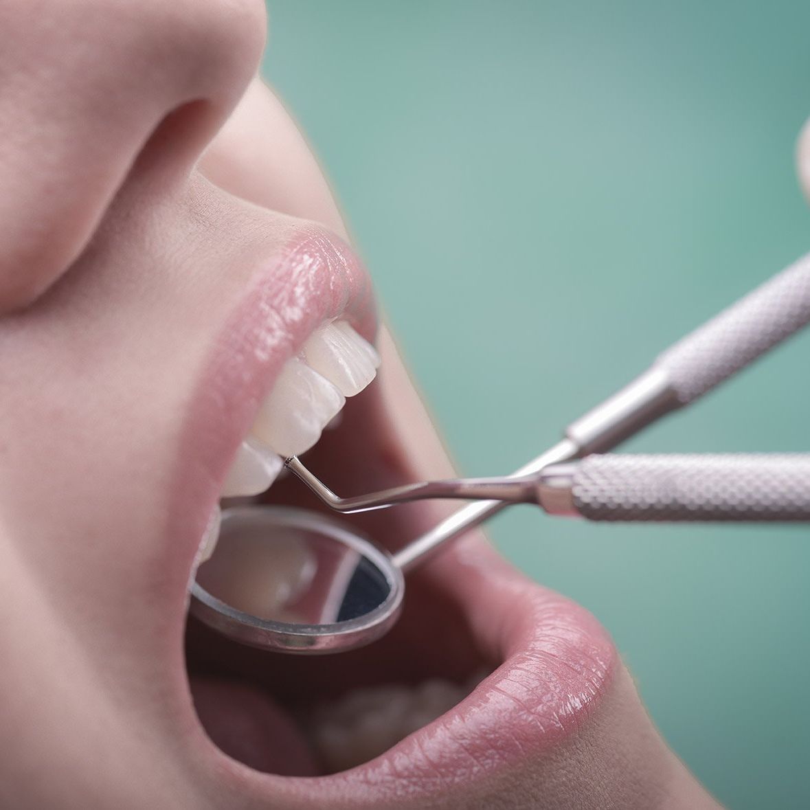 Perk Dental | Manvel Dentist|dentist in manvel texas|dentist in manvel tx