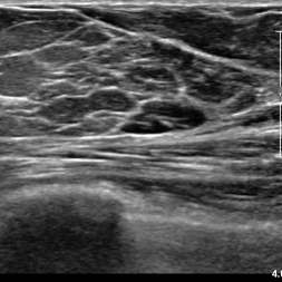 Alfa-Scan Diagnostic