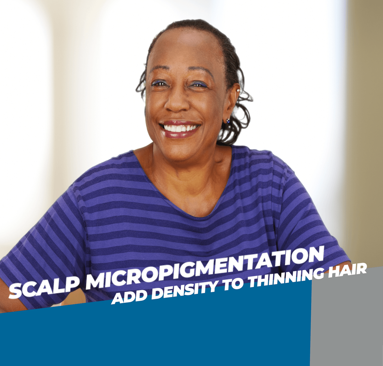 Check Out The 7 Amazing Benefits Of Scalp Micropigmentation