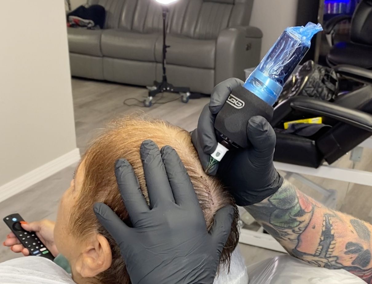 How To Fnd The Best Scalp Micropigmenation (SMP) Artists In Tampa