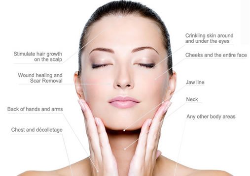 Vampire Facelift | Markham, ON | Toronto Medical Aesthetics
