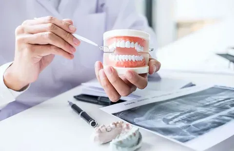 Dental Procedures Explained: A Comprehensive Guide to Fillings, Root ...