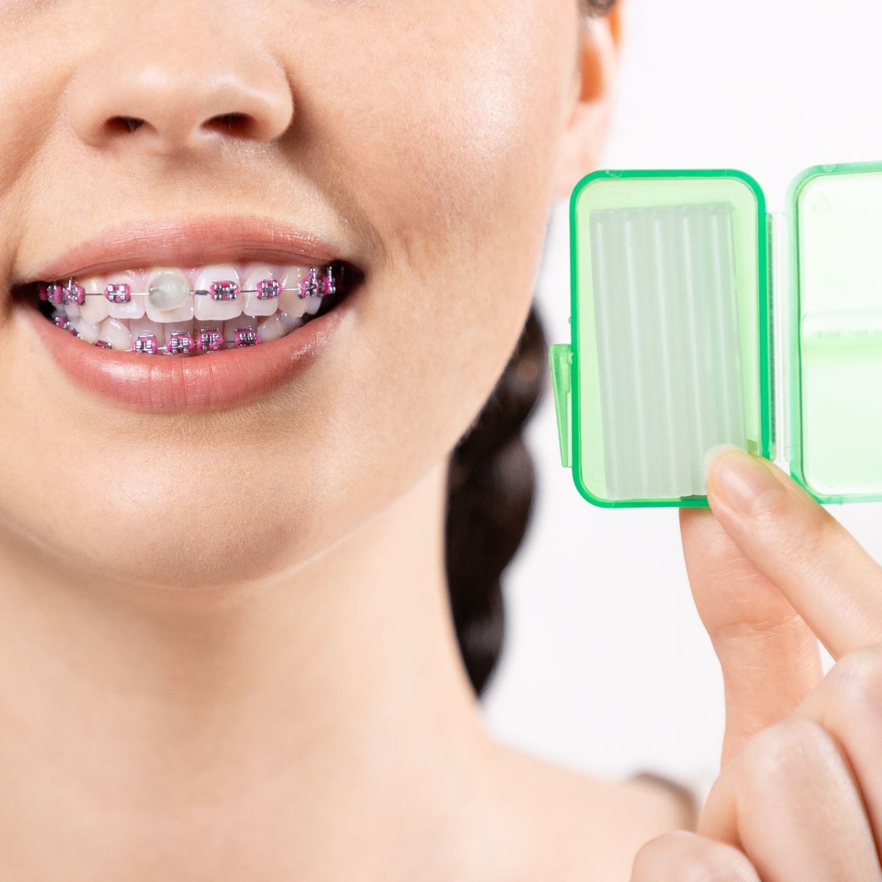 Dental Braces Wax