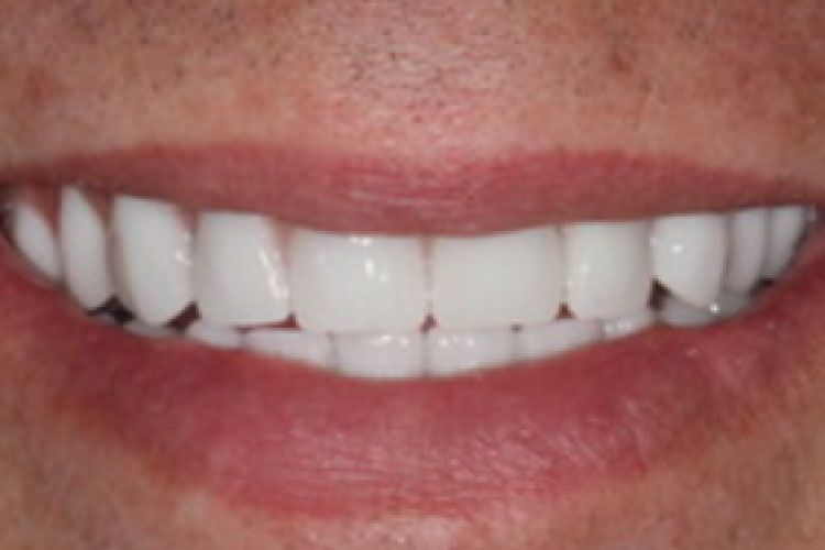 Modern Day Smiles Before and Afters | Our Work