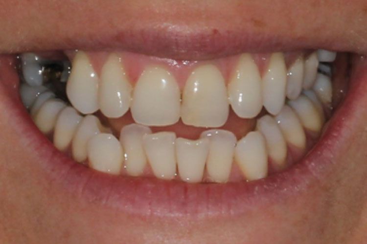 Modern Day Smiles Before and Afters | Our Work