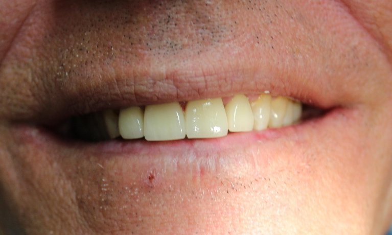 Modern Day Smiles Before and Afters | Our Work