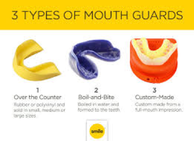 Benefits of a Custom Mouth Guard for Grinding Teeth