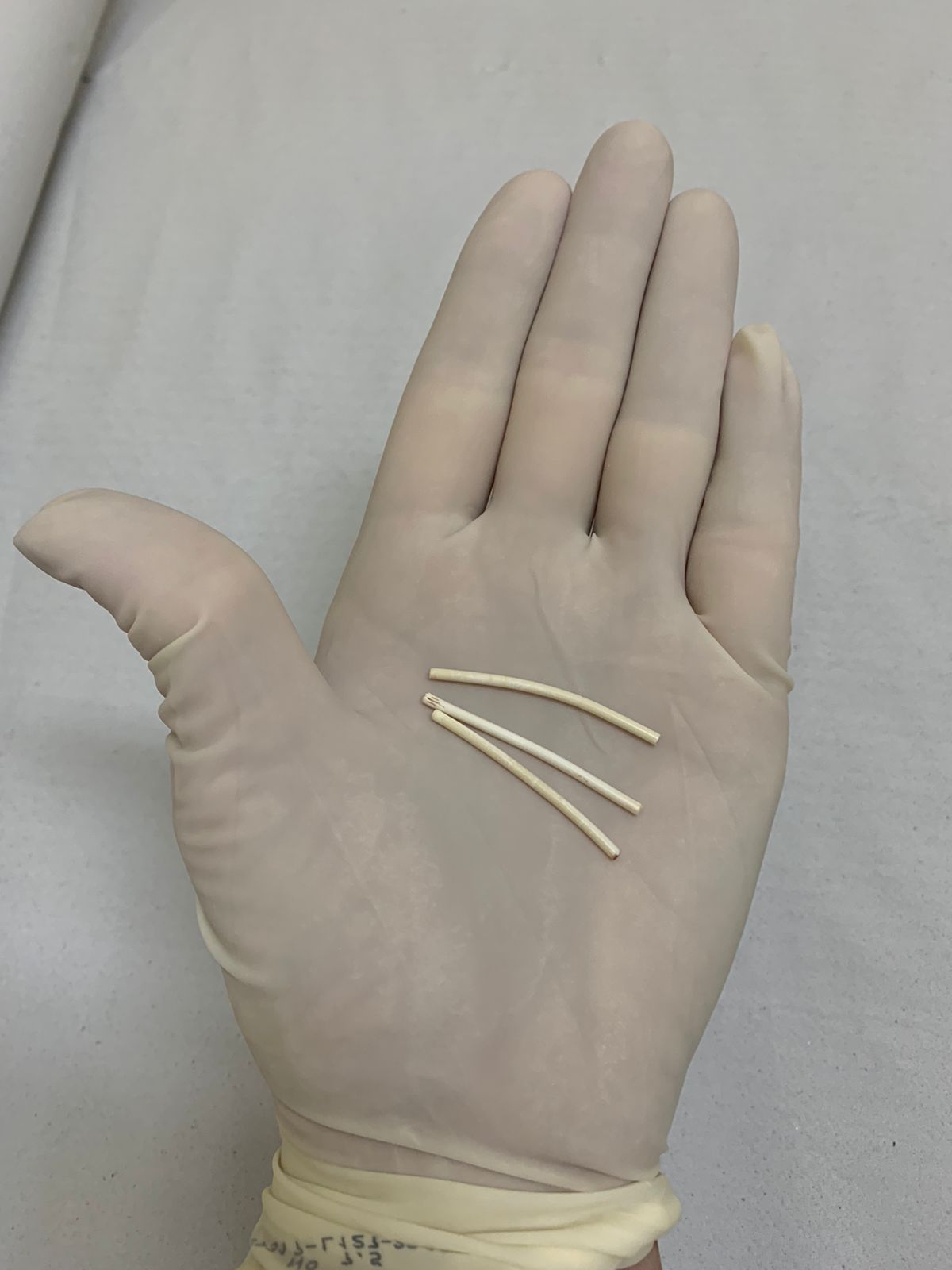 Implante contraceptivo: quais as vantagens e como funciona?