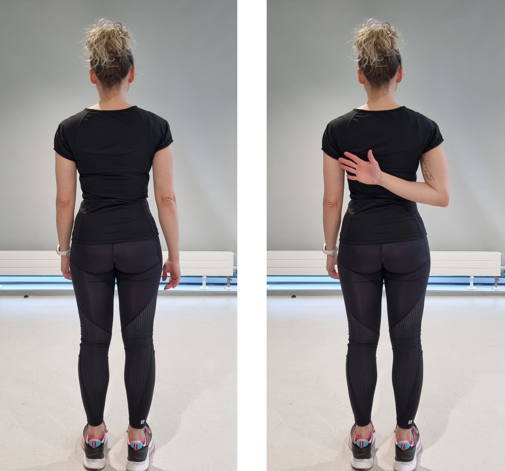 Post-operative Exercises