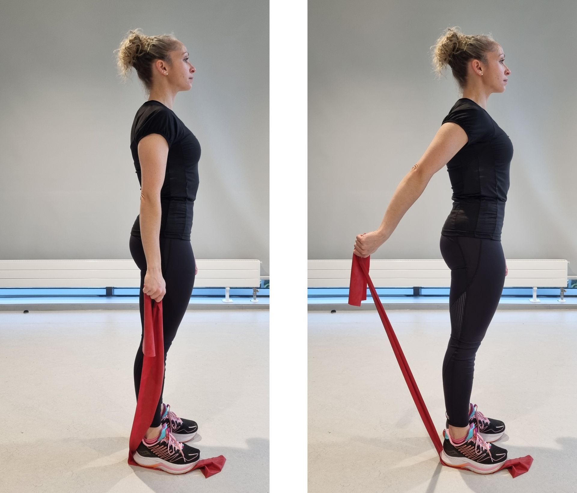 Post-operative Exercises