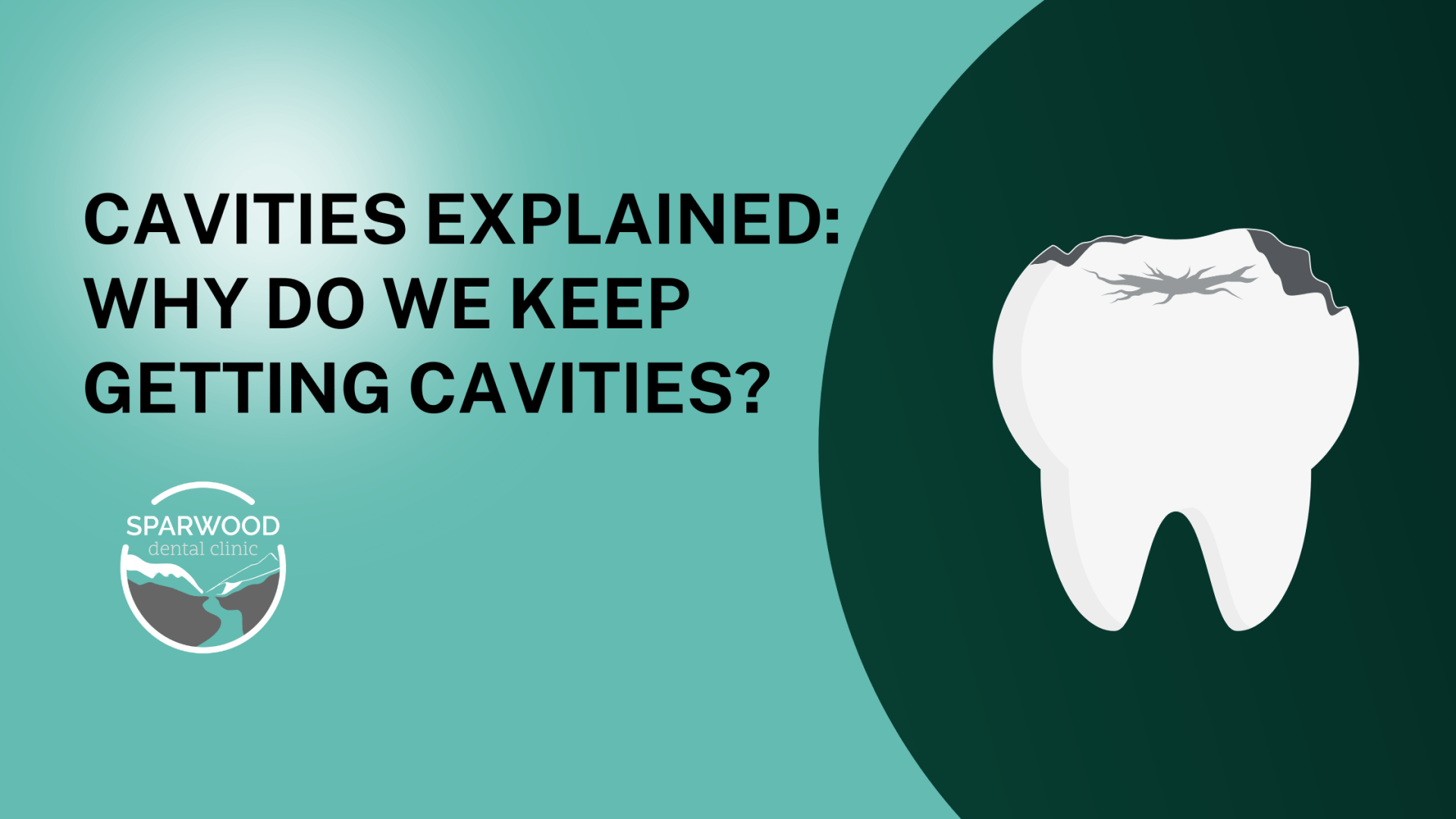 Cavities Explained: Why Do We Keep Getting Cavities?