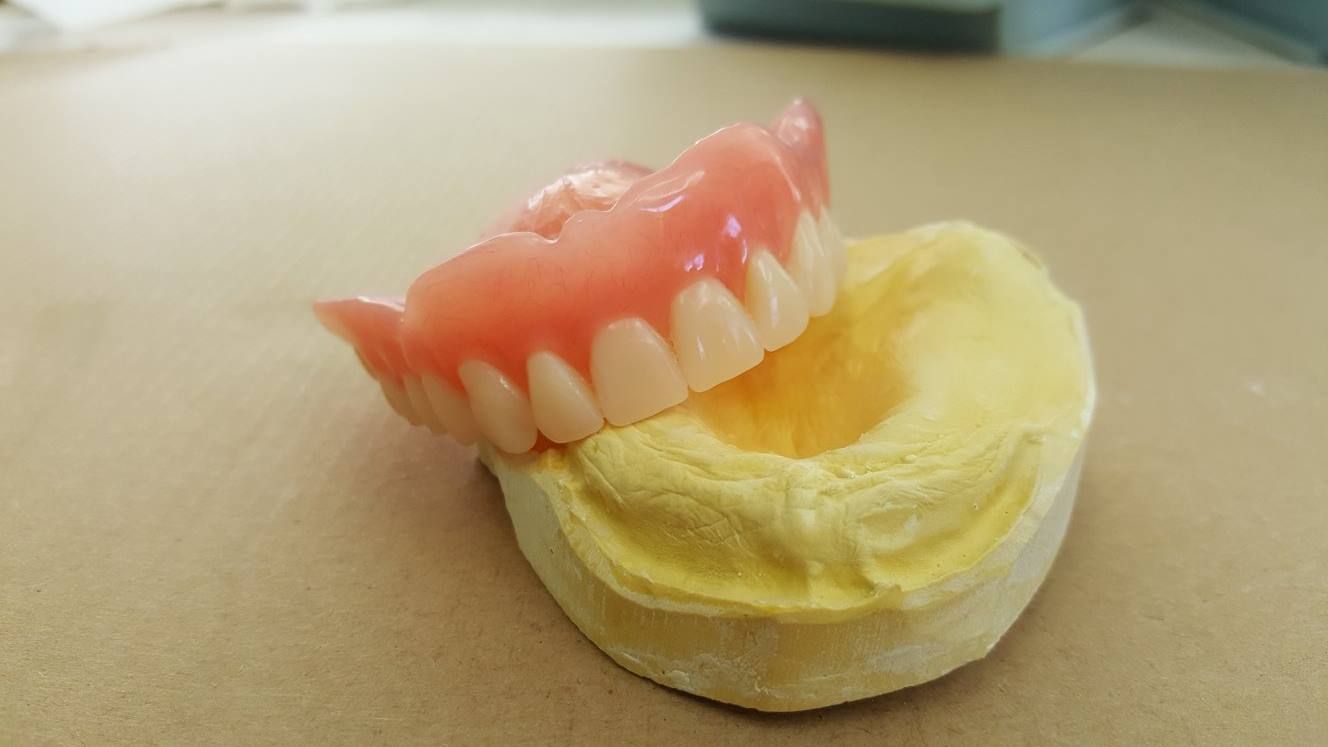 Our Denture Work | Onekawa, Napier | Hawkes Bay Denture Care