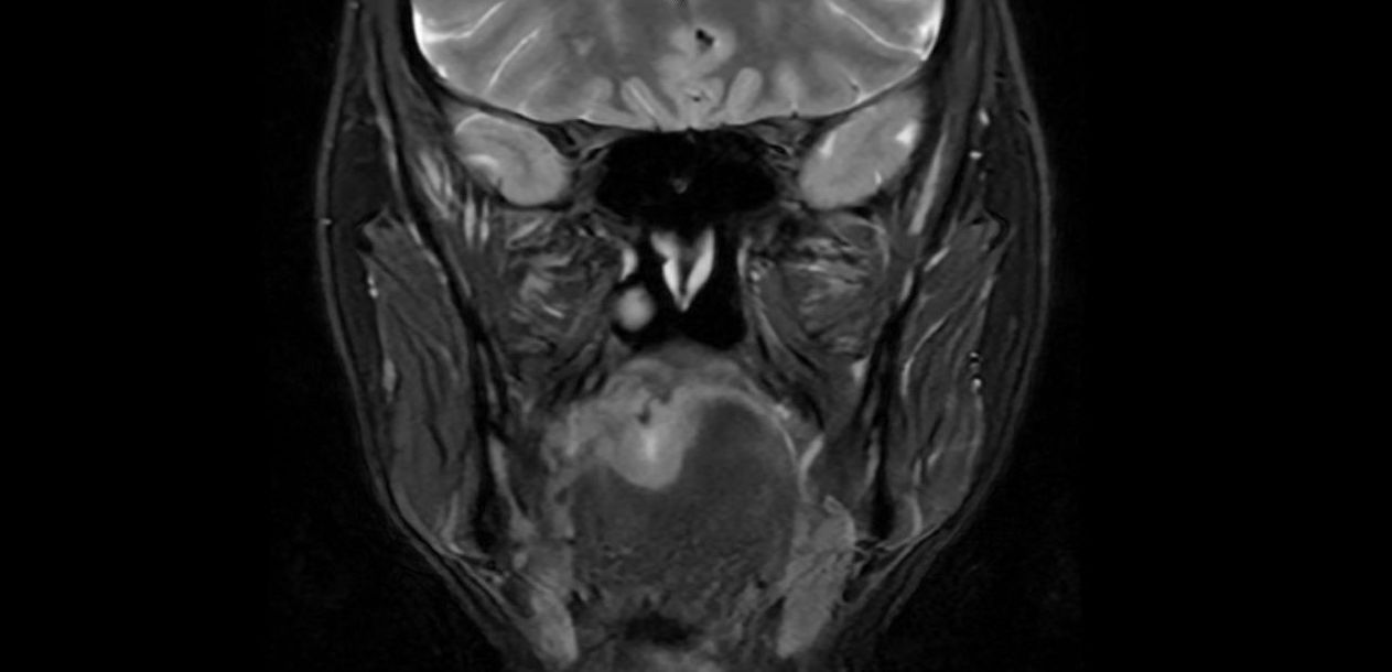 IRM ORL-Imagerie Médicale Paris 19