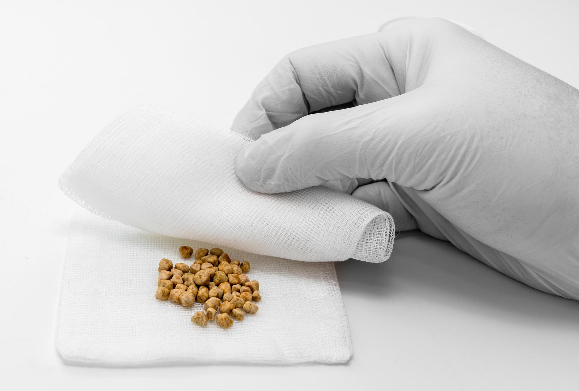 Gallstones Removal Surgery in Singapore | Colorectal Clinic