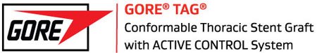 Conformable GORE® TAG® Thoracic Endoprosthesis with ACTIVE CONTROL System