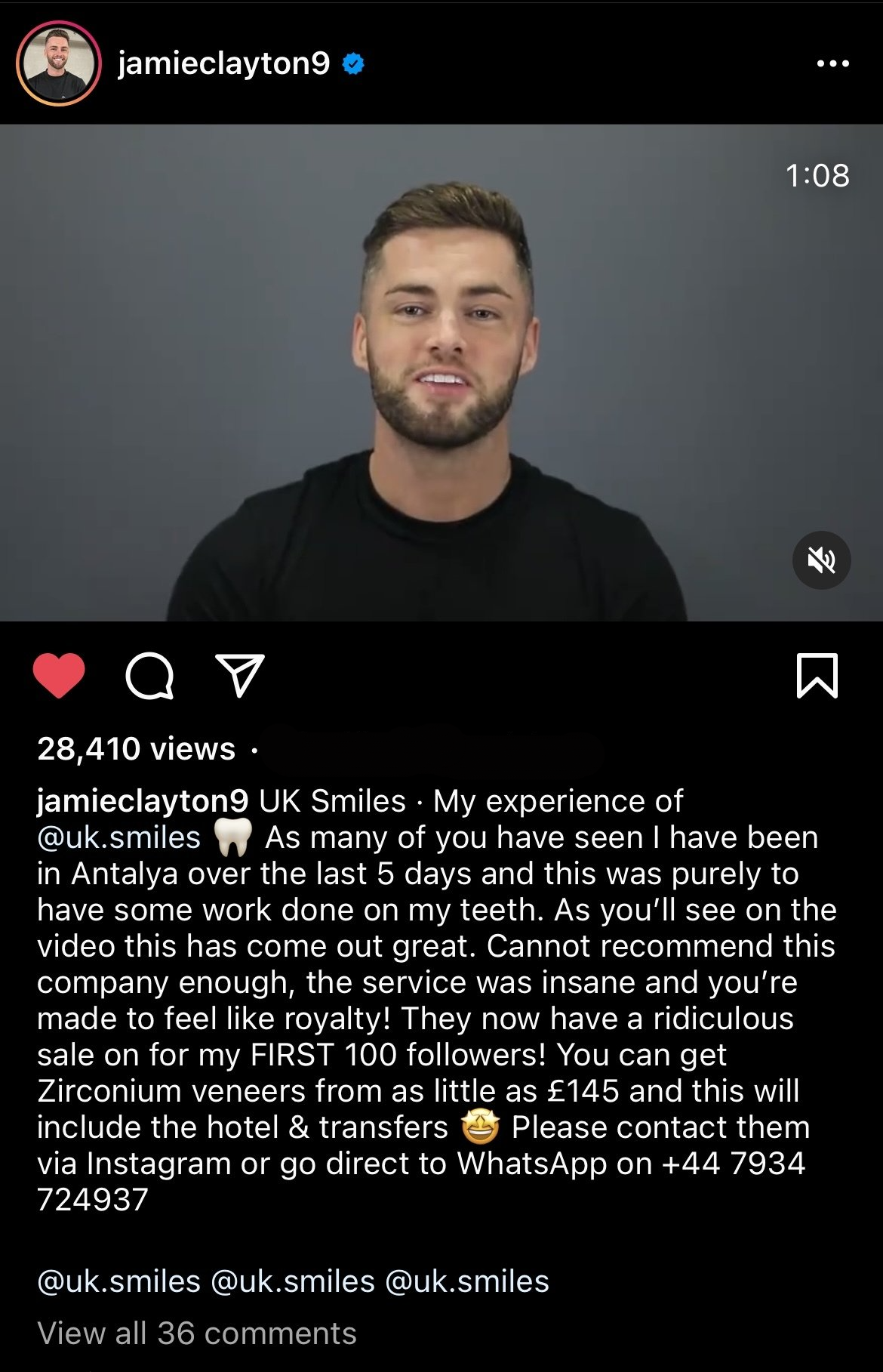 UK Smiles - #1 In Turkey Teeth Dental Treatments