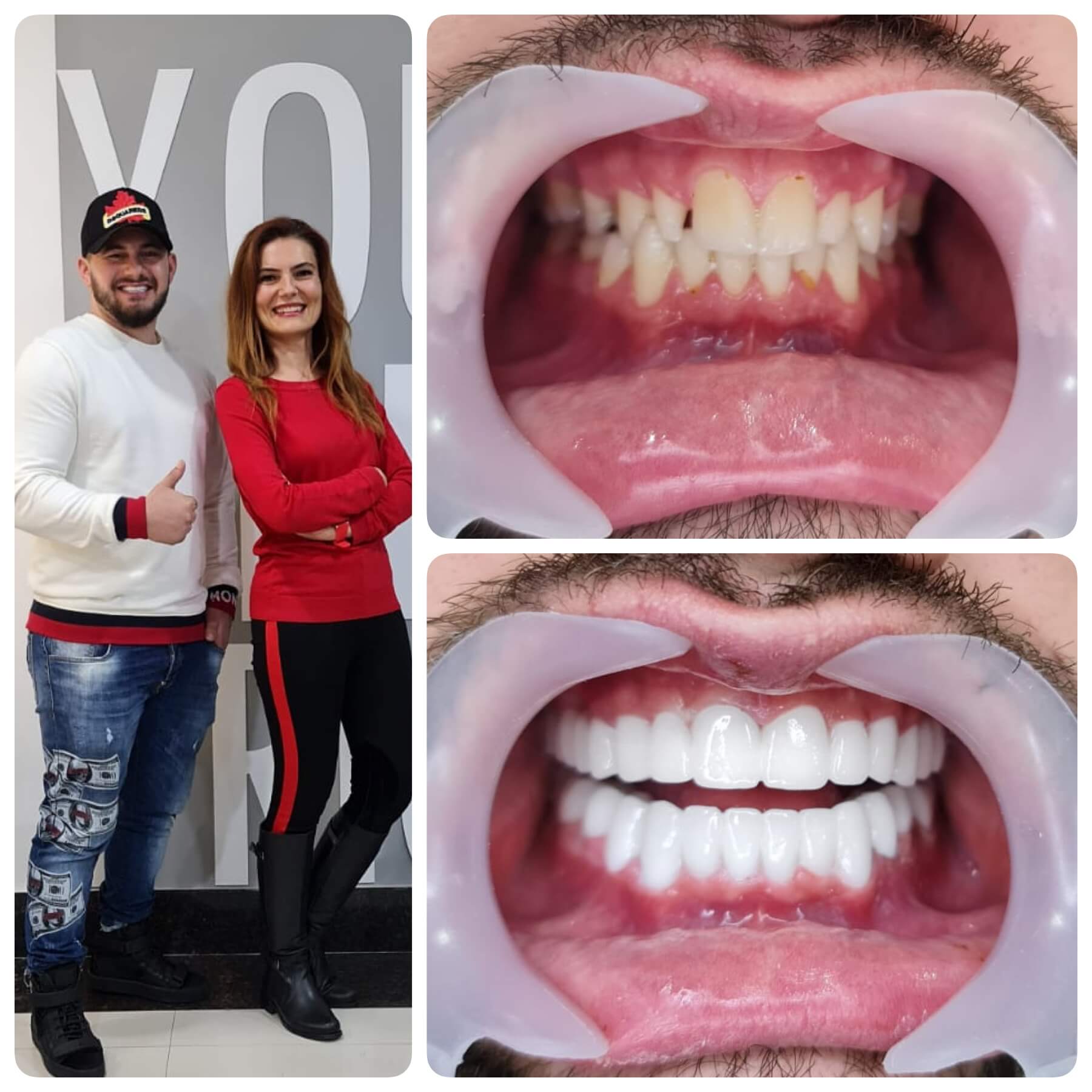 UK Smiles - #1 In Turkey For Dental Treatments