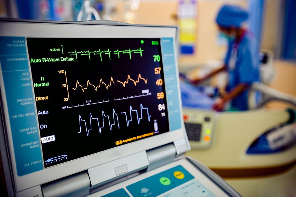 Thallium (nuclear) Stress Test