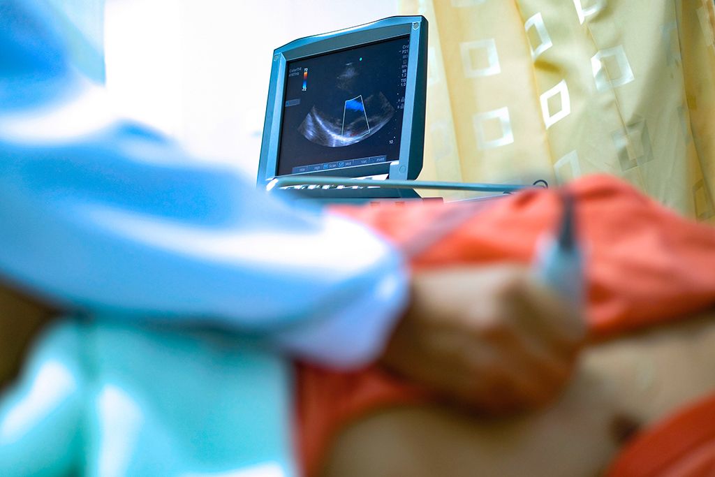 Thallium (nuclear) Stress Test