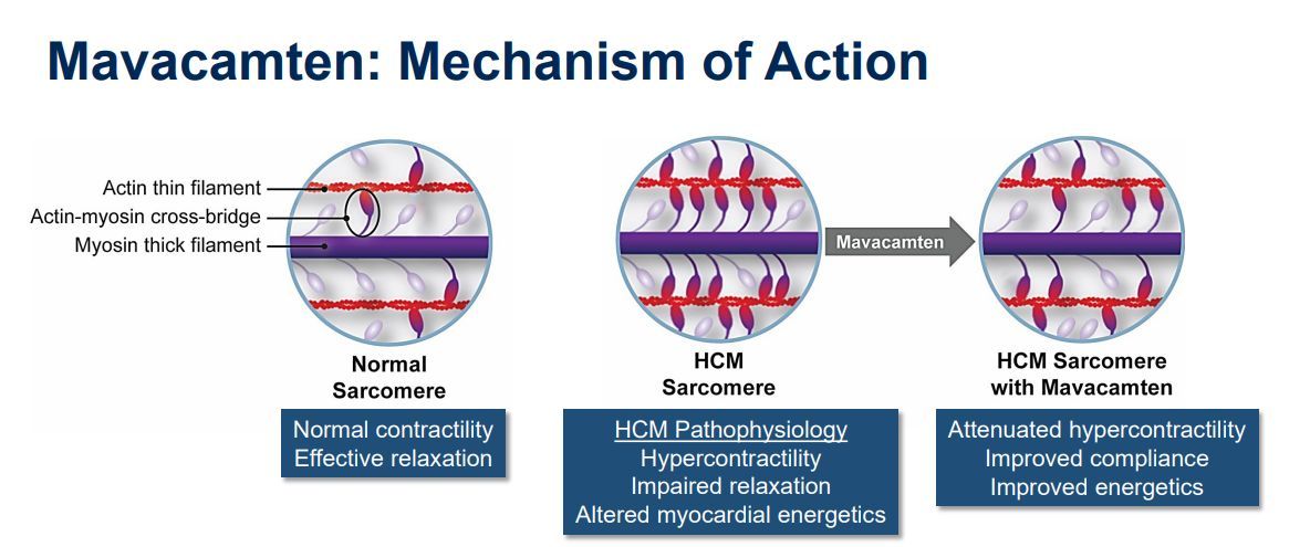 How Camzyos works, how to access it, and patient help