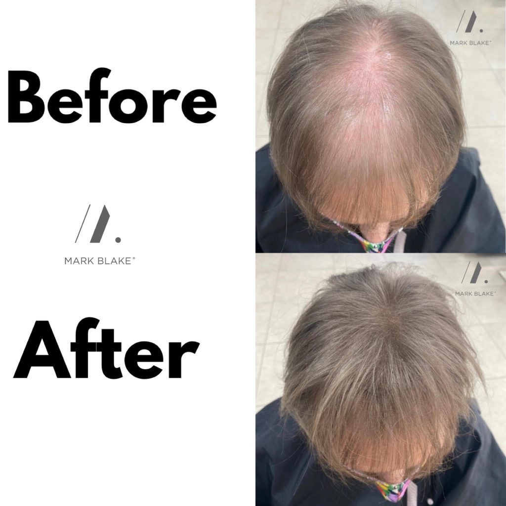 About Mark Blake® Trichology