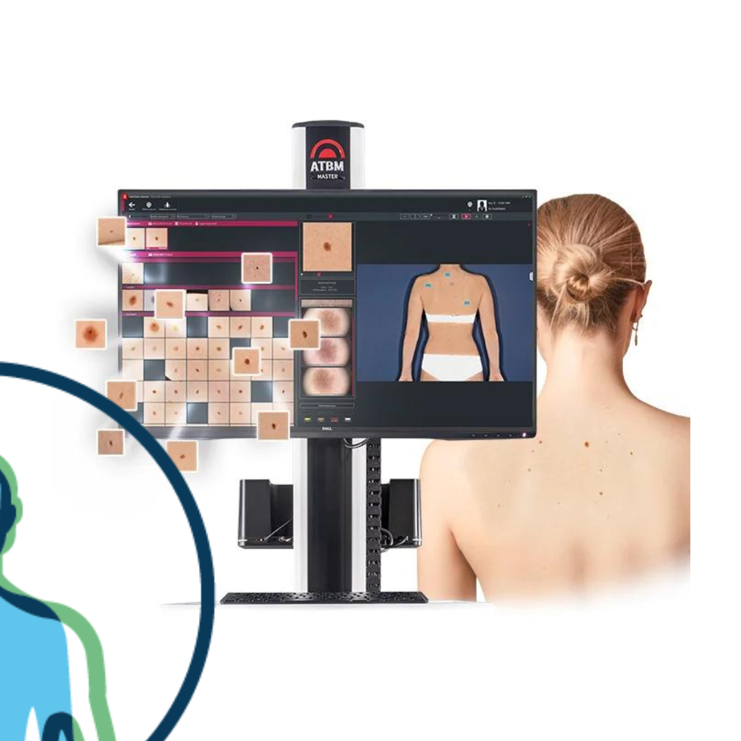 Mole Findr Digital Skin Cancer Surveillance
