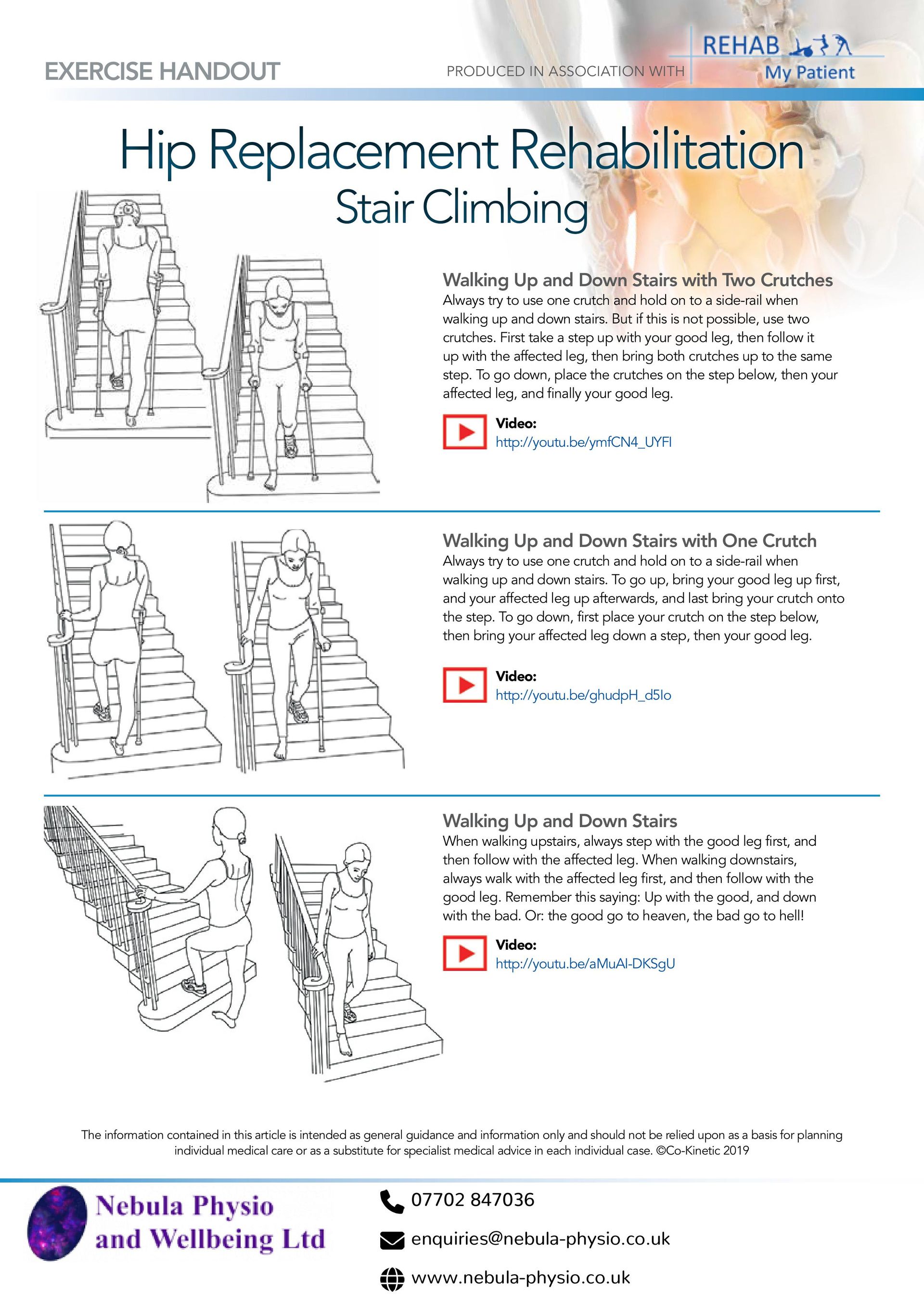 Climbing Stairs After A Hip Replacement