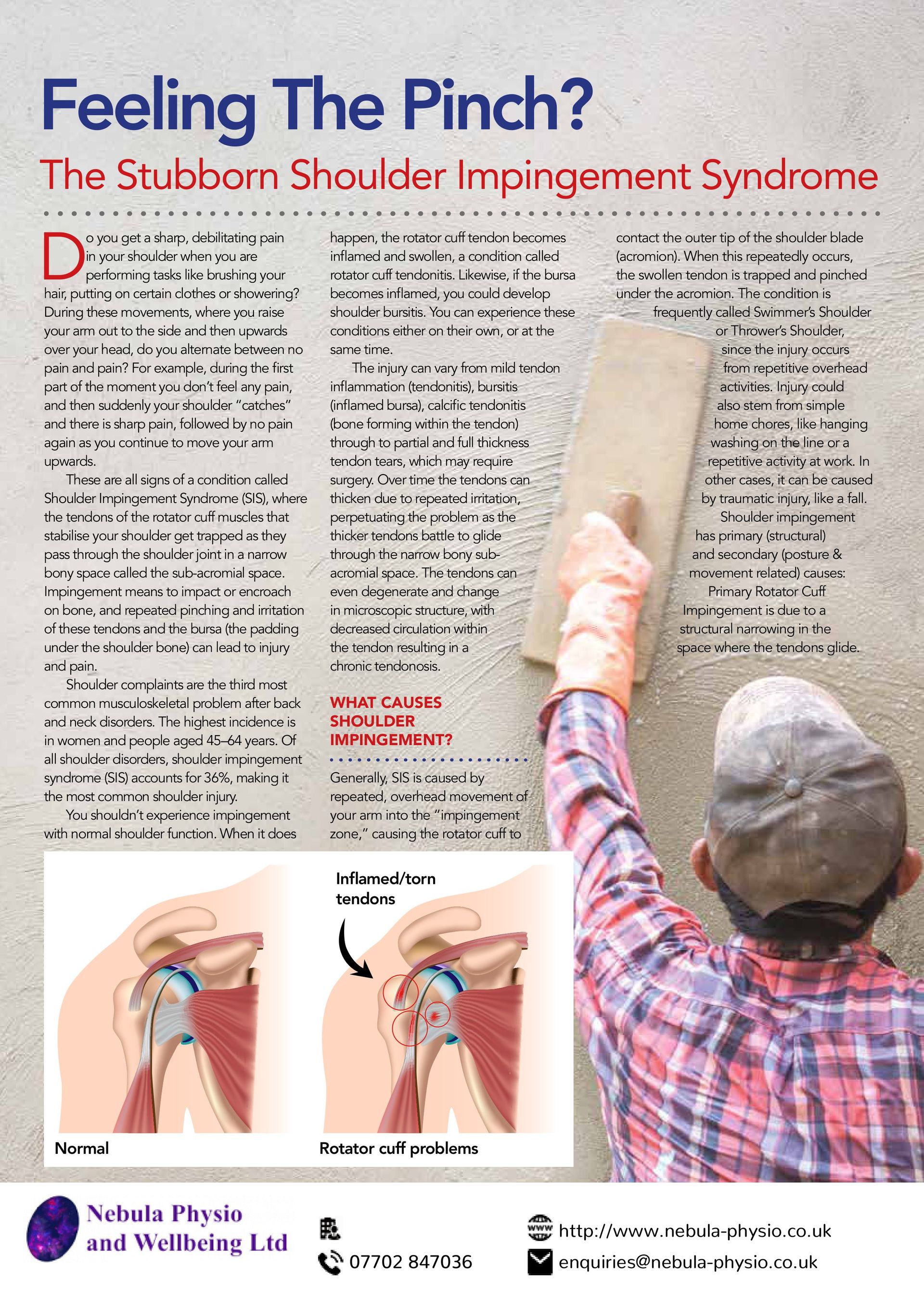Shoulder Impingement