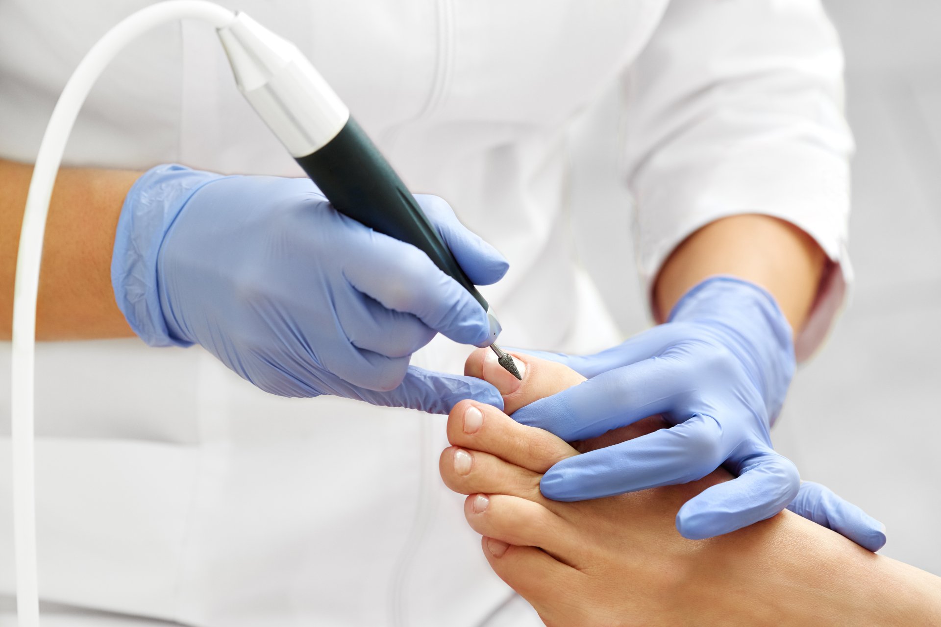 Podiatrist Near Whitleigh | Foot Clinic Plymouth