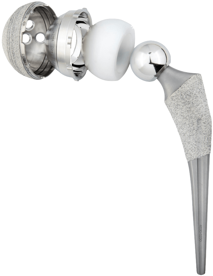 Hip Replacement | Align Orthopaedics | South Brisbane