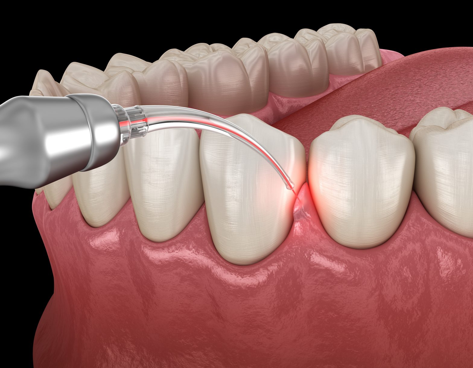 Holistic Periodontist | Lexington, KY | Modern Periodontics
