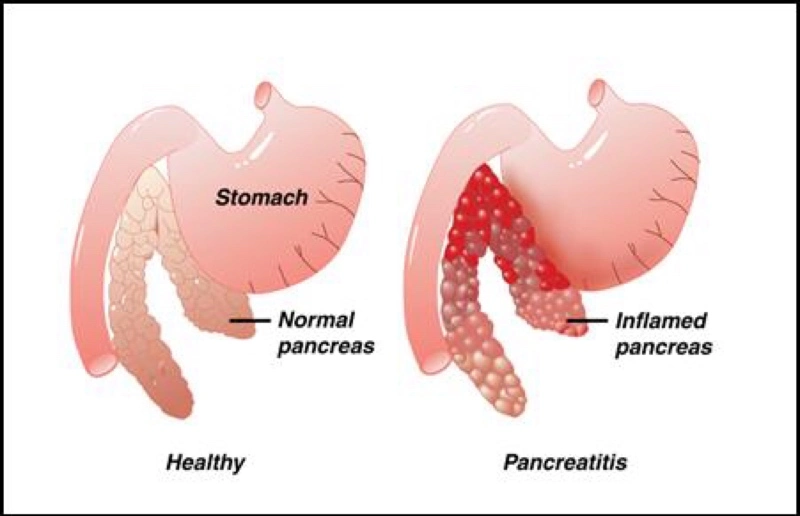 Pancreatitis In Dogs Pancreatitis In Dogs