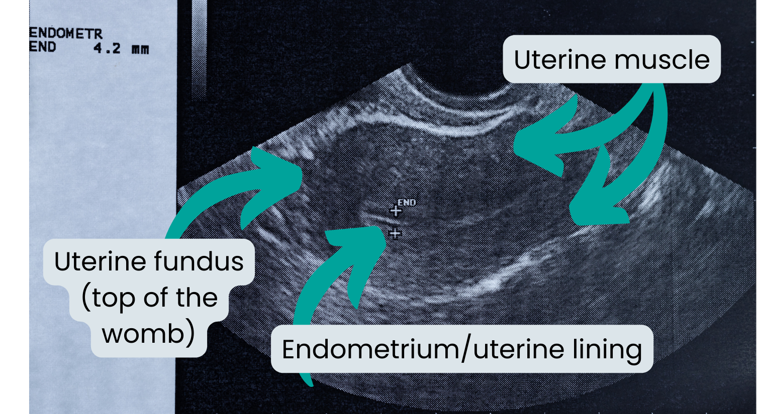 INVESTIGATION: USS Pelvic Ultrasound Scans