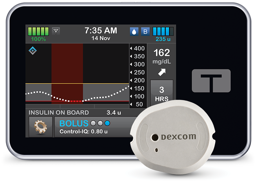 Dexcom G7 | Columbus, OH | 614-481-9841 Dexcom G7 | Columbus, OH | 614-481-9841