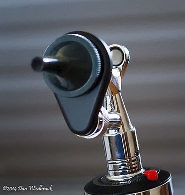 Eustachian Tube Dysfunction (ETD)