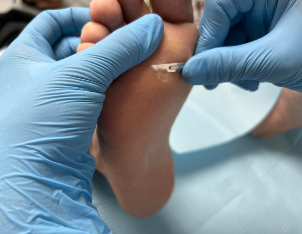 Medisch Pedicure Lieke Harbrinkhoek