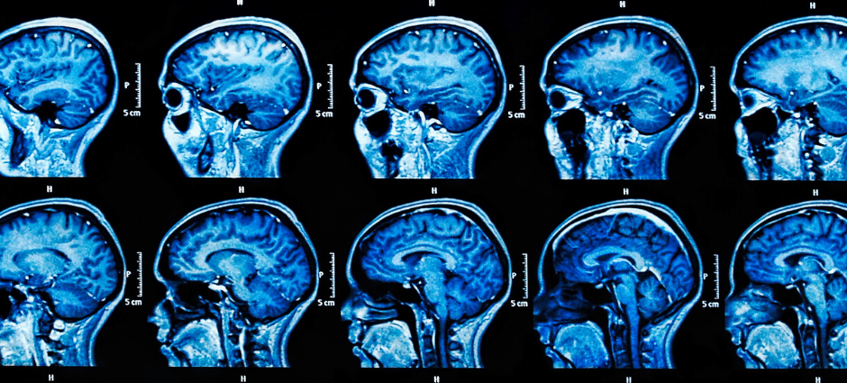 Facts About The Development Of Your Child’s Prefrontal Cortex