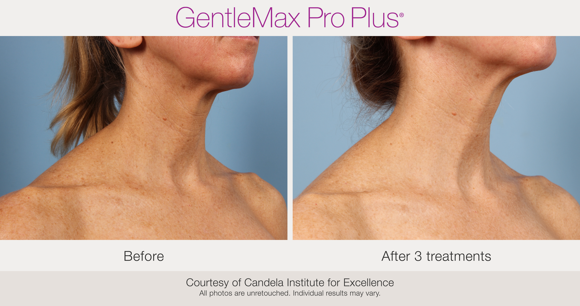 Aesthetic Treatments Gallery | Macon Laser Company | GA