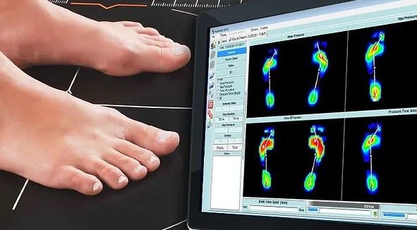 Metatarsalgia: conheça o que é, causas e tratamento
