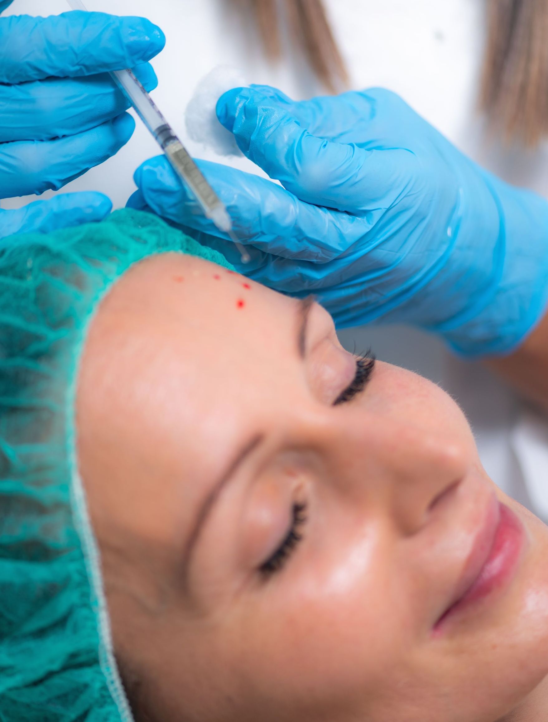 PRP Treatments | Oakville, ON | Tufford Medical Aesthetics