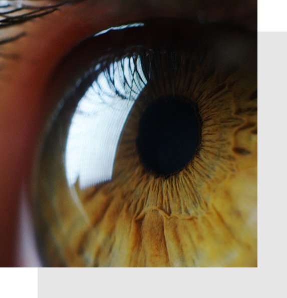 Epi-Clear in Waxahachie | Texas Eye and Cataract