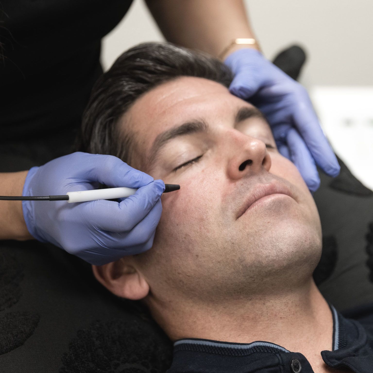 ThermoClear Pro | Calgary, AB | Britannia Dermedics