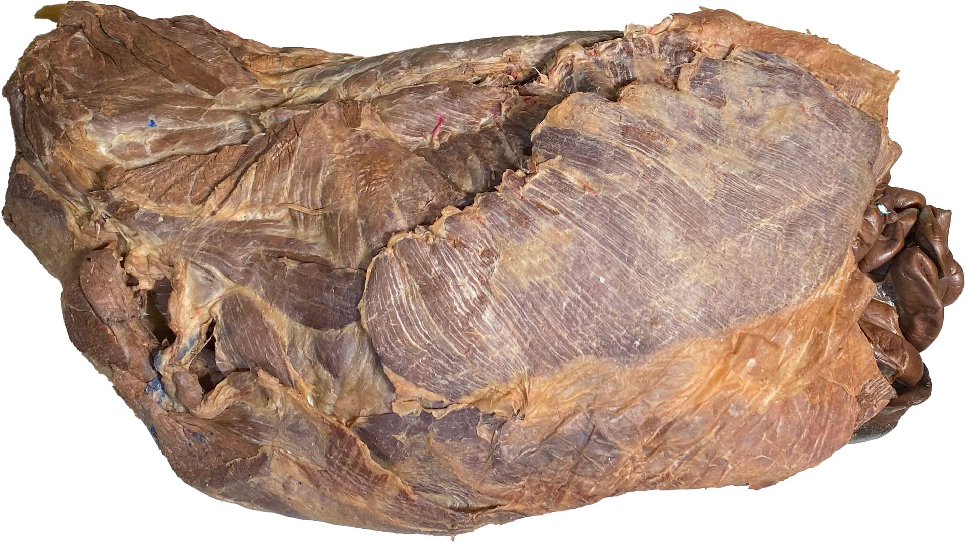 Thorax and abdomen of the dog