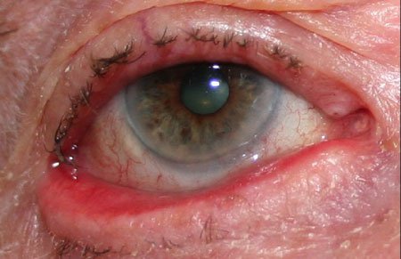 Visionary Eye Specialists | Ophthalmic Eye Surgeons Sydney