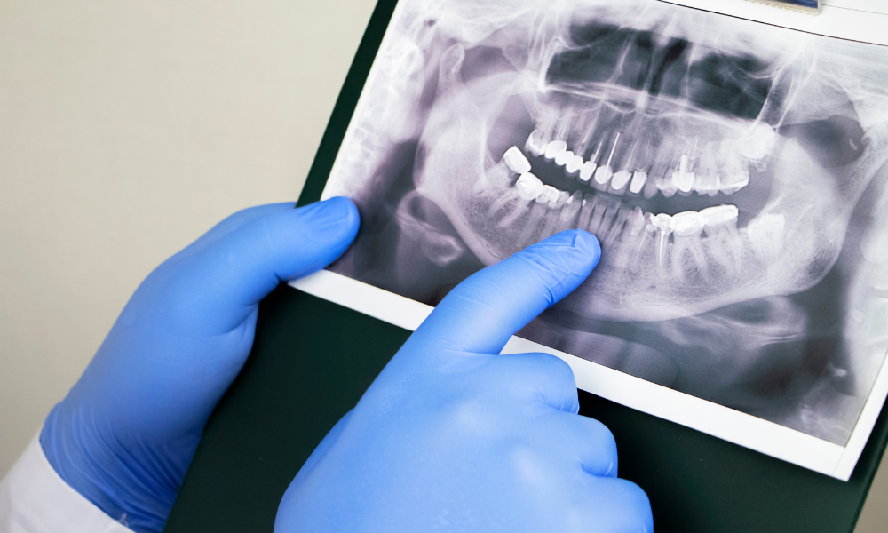 Why Dr. Jared Bloxham Is One of the Leading TMJ Specialists in ...