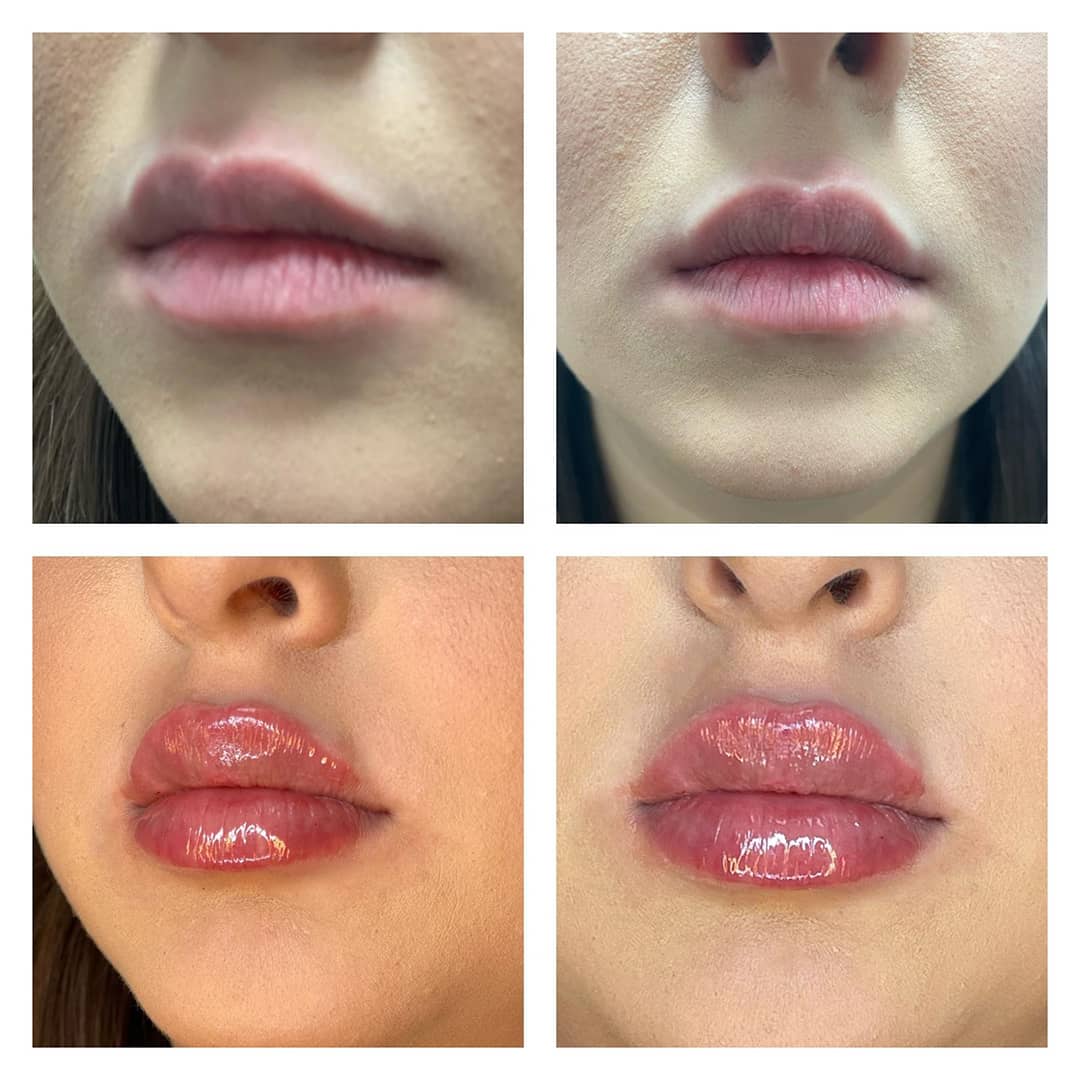 Before and After Gallery | Clinic 45 | Houston, TX