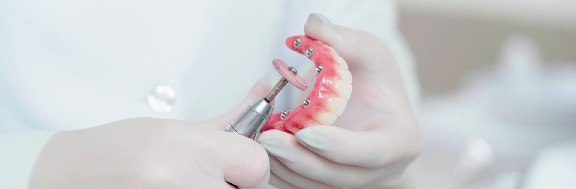 Prótese protocolo: saiba tudo sobre ela